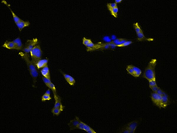 SK-MEL-147 Human Melanoma Cell Line | SCC440